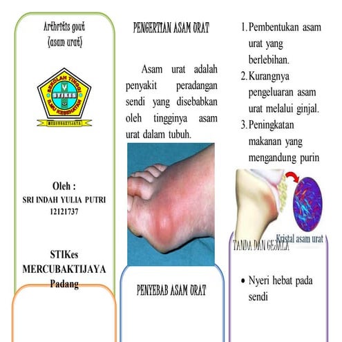 Arthritis gout leaflet indah | DOCX