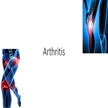 A powerpoint presentation on Arthritis.. | PPTX
