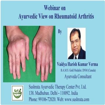 Ayurvedic view on Rheumatoid Arthritis | PDF