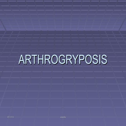 Arthrogryposis | PPT