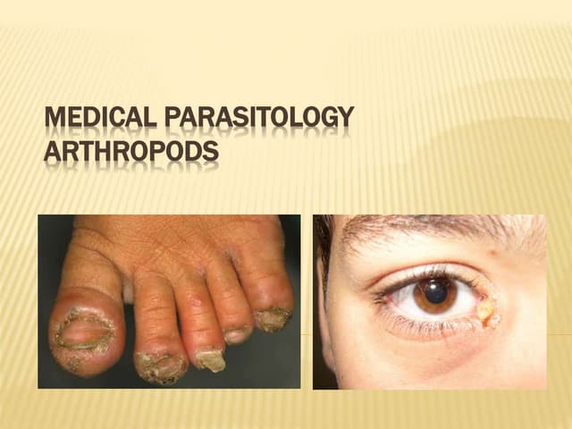 Vector borne disease | PPTX