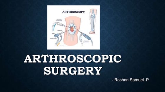 Arthroscopic Surgery.pptx