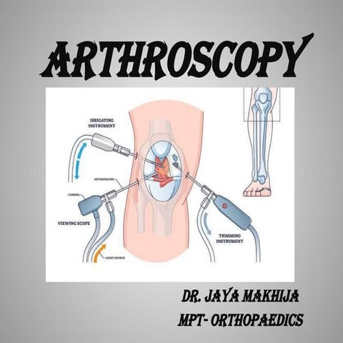 ARTHROSCOPY and its procedure with uses in PT | PPTX