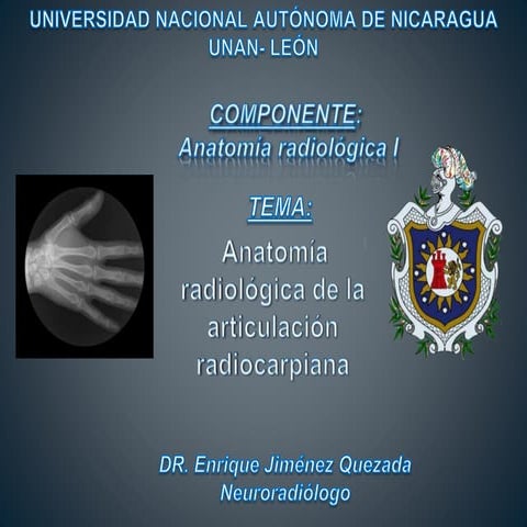 Articulacion radiocarpiana | PPTX