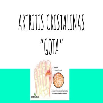 Gota enfermedad en las articulaciones | ODP
