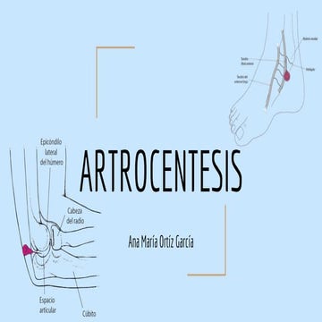 ARTROCENTESIS traumatologia y ortopedia.pptx