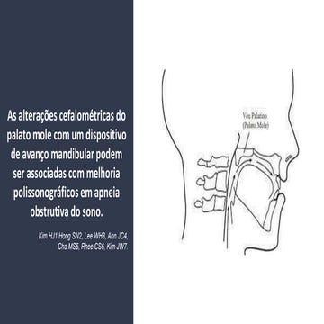 As alteracoes cefalometricas do palato mole com um dispositivo de ...