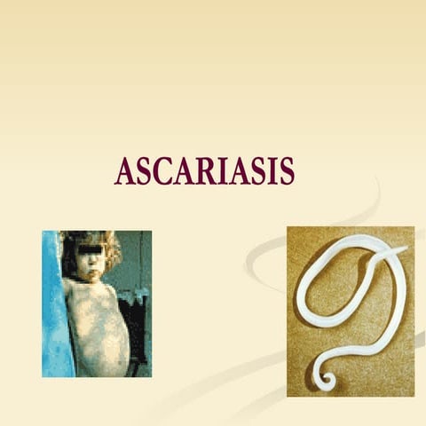 ASCARIASIS from defination to treatment . | PPT