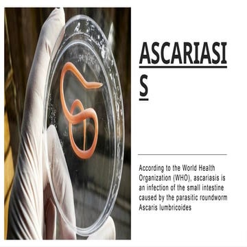 ASCARIASIS a disease of human that is destroying lives | PPTX