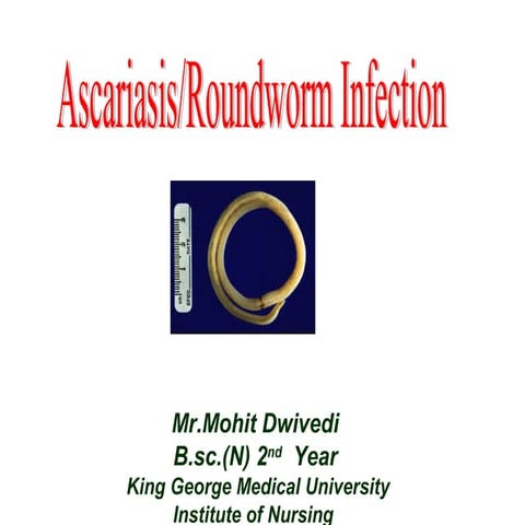 Ascariasis Images Bmj Best Practice Us Prevalence, Intensity, And