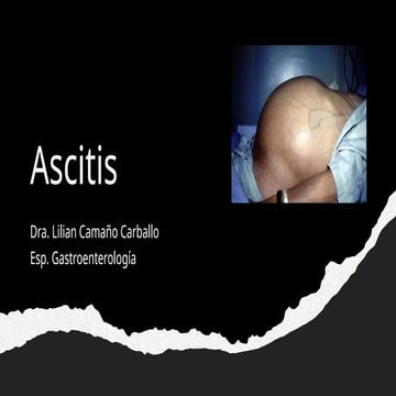 Manejo de ascitis en cirrosis.pptx