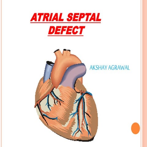 Patent Ductus Arteriosus (PDA) | PPTX
