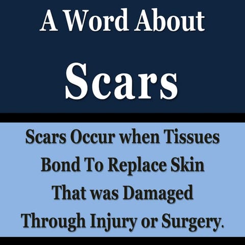 A segment on scars | PPT