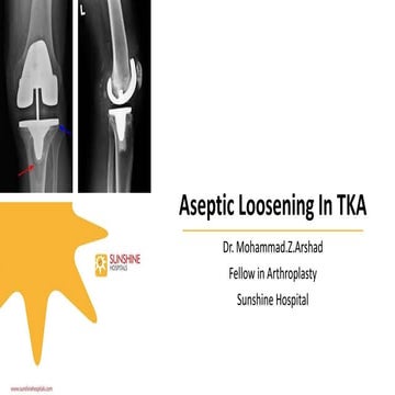 How to Interpret Postoperative X- ray after Total knee arthroplasty.pptx