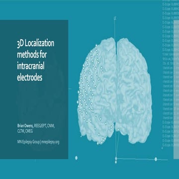 3d Localization Methods For Intracranial Electrodes Ppt