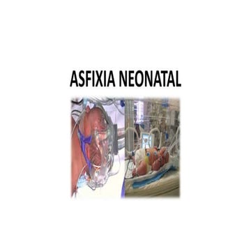 Asfixia neonatal | PPTX