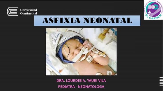 Asfixia neonatal , reanimacion neonatal de los primeros minutos | PPTX