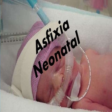 Asfixia neonatal grupo 5 | PPTX