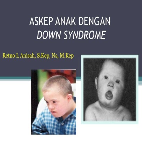 ASUHAN KEPERAWATAN ANAK DGN DOWN SYNDROME.ppt