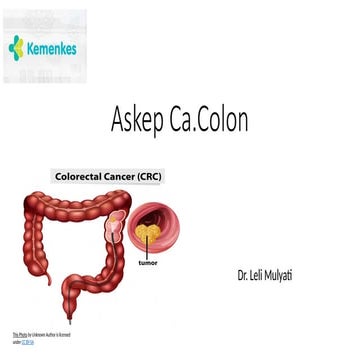 Asuhan keperawatan pada pasien Ca Colon.pptx