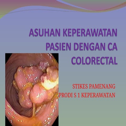 Asuhan keperawatan pasien dengan Ca Colorectal | PPT