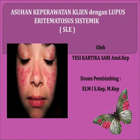 Askep sle | PPT