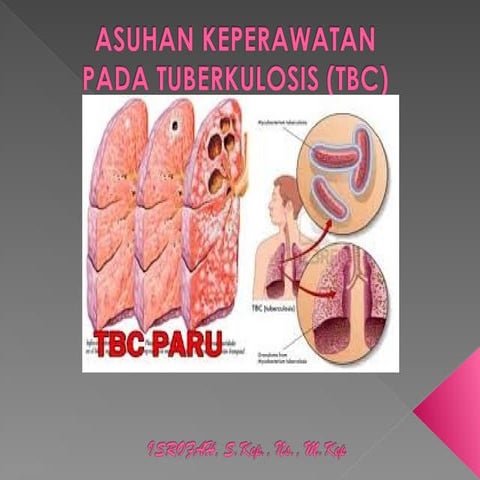 ASKEP TB PARU........................... | PPT