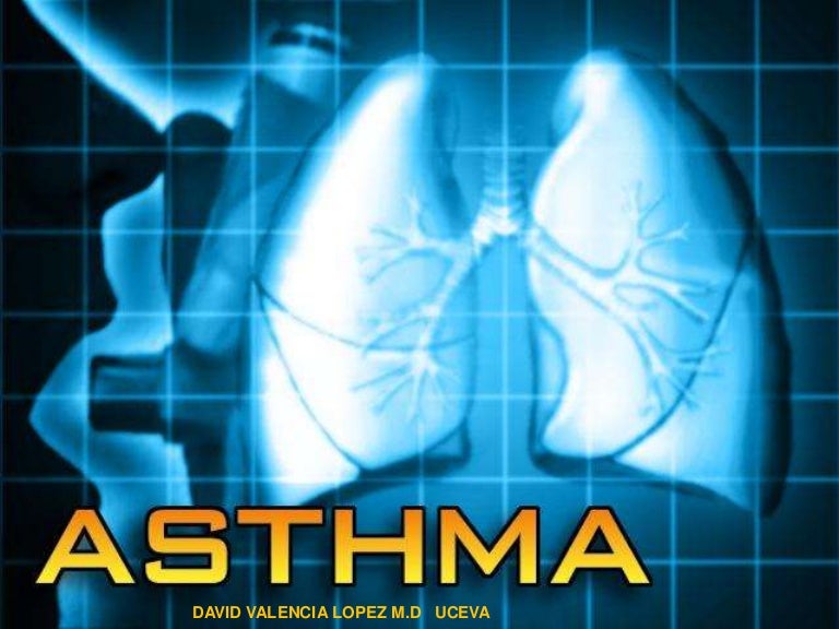 Asma