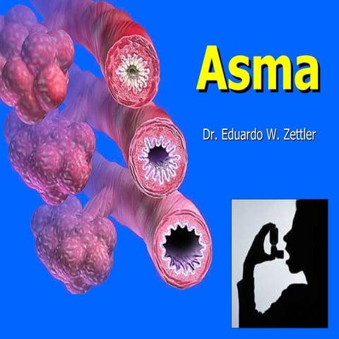 Asma | PPT