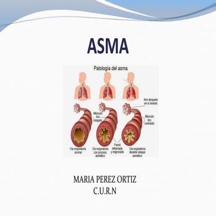 Asma gina | PPT