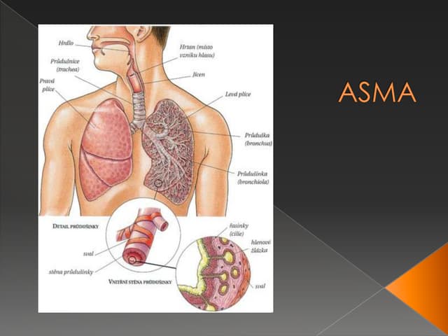 Penyakit pernafasan (Asma) | PPTX