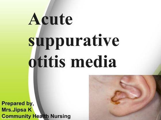 Acute Suppurative Otitis Media | PPT