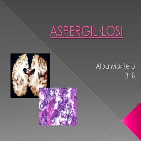 Aspergil·losi | PPTX