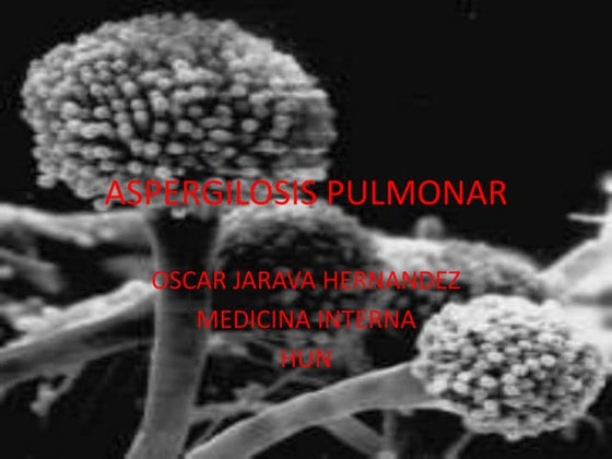 Aspergil·losi | PPTX