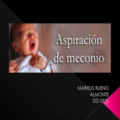Aspiracion del Meconio | PPSX