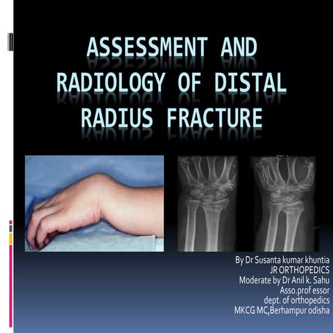 Assessent and radiology of distal end radius fracture | PPT