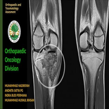 Comprehensive Case Study on Primary Bone Tumor of the Left Distal Femur ...