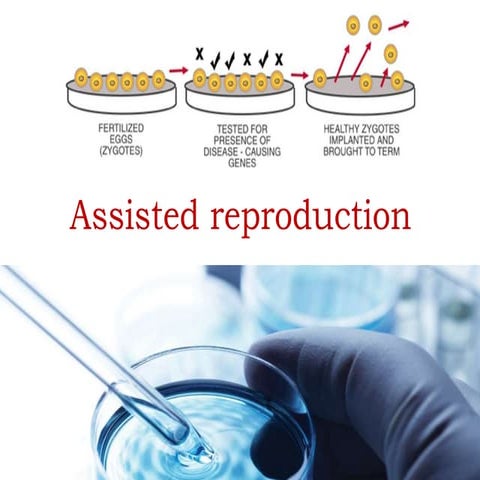Assisted Reproductive Technology