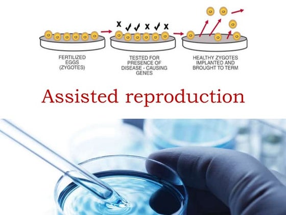 Assisted Reproductive Technology | PDF
