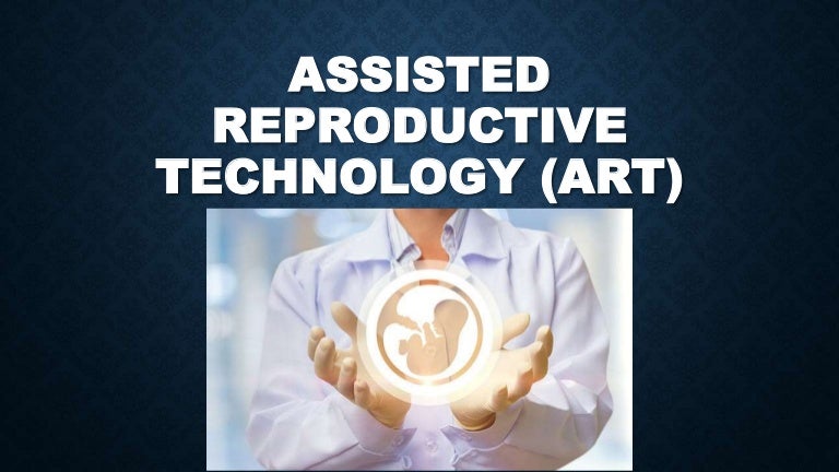 Assisted Reproductive Technology