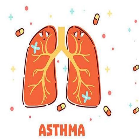 Asthama | PPTX