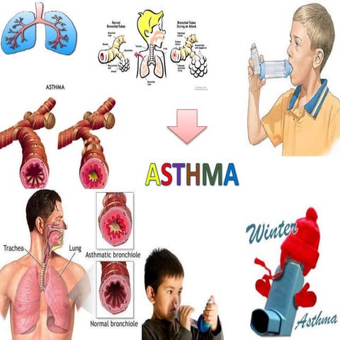 Asthma Lecture For Medical Students 2.pptx