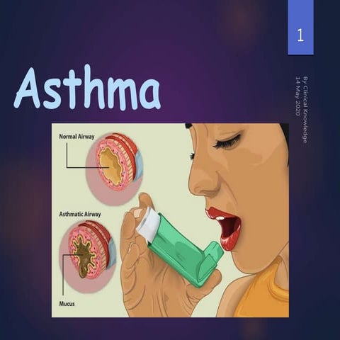 Asthma | PPTX | Lung and Respiratory Health | Diseases and Conditions