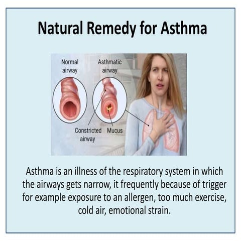 Asthma8 | PPT