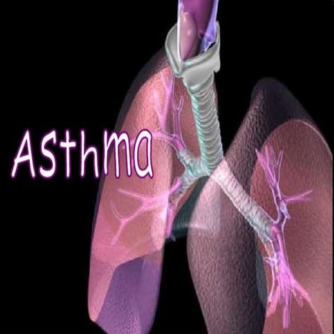 Asthma ppt | PPTX