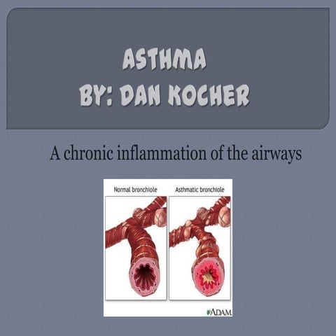Asthma project | PPTX