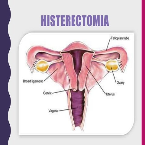 Procedimiento Quirúrgico De Histerectomía Vaginal Ppt