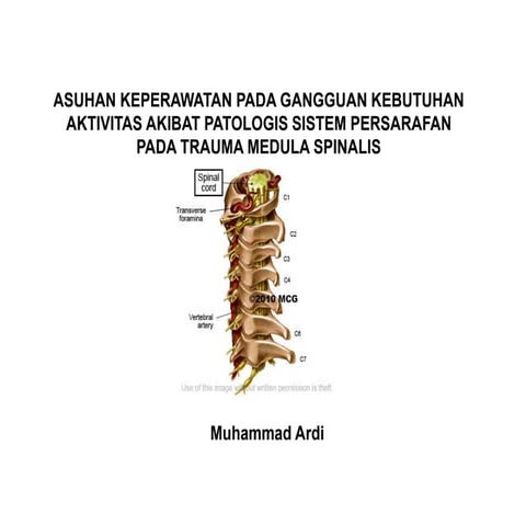 Asuhan keperawatan pada trauma medula spinalis | PDF