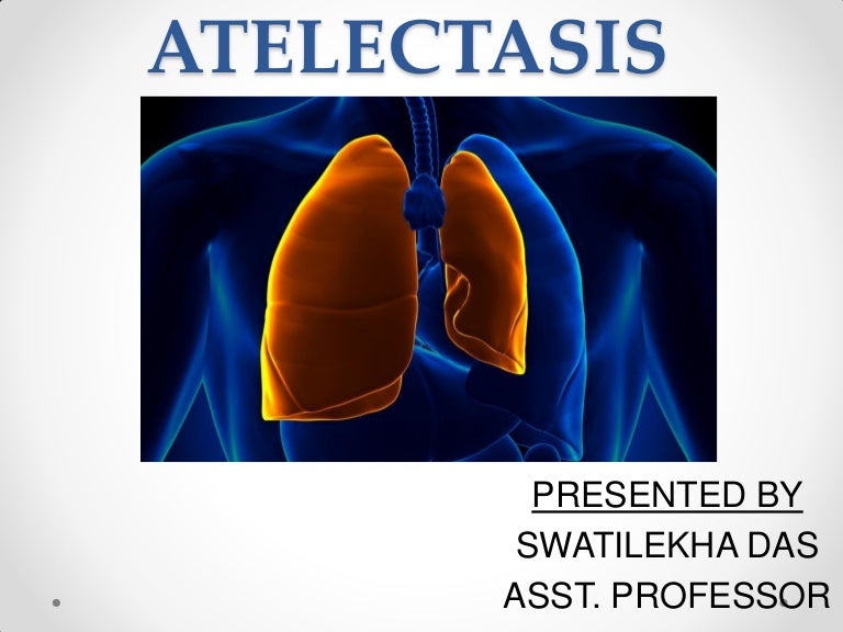 Lessons I Learned From Tips About How To Prevent Atelectasis - Unfuture38