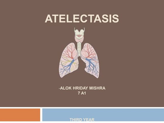 Medical Imaging Presentation - ATELECTASIS.pptx